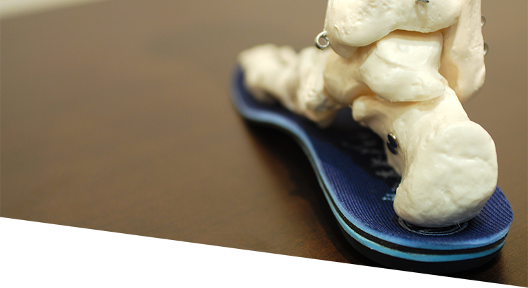 Custom Foot Orthotics | Cornerstone Clinic