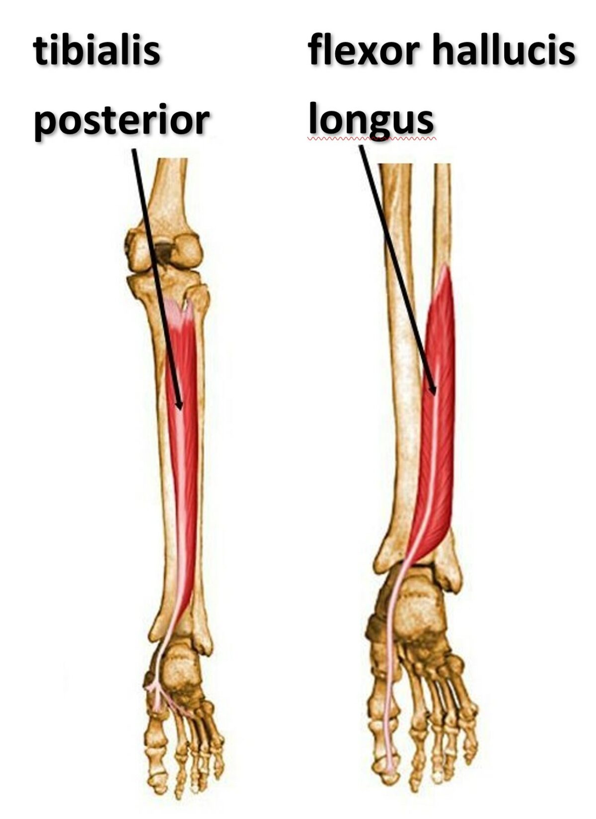 Plantar Fasciitis - Our Complete Guide | Cornerstone Physiotherapy
