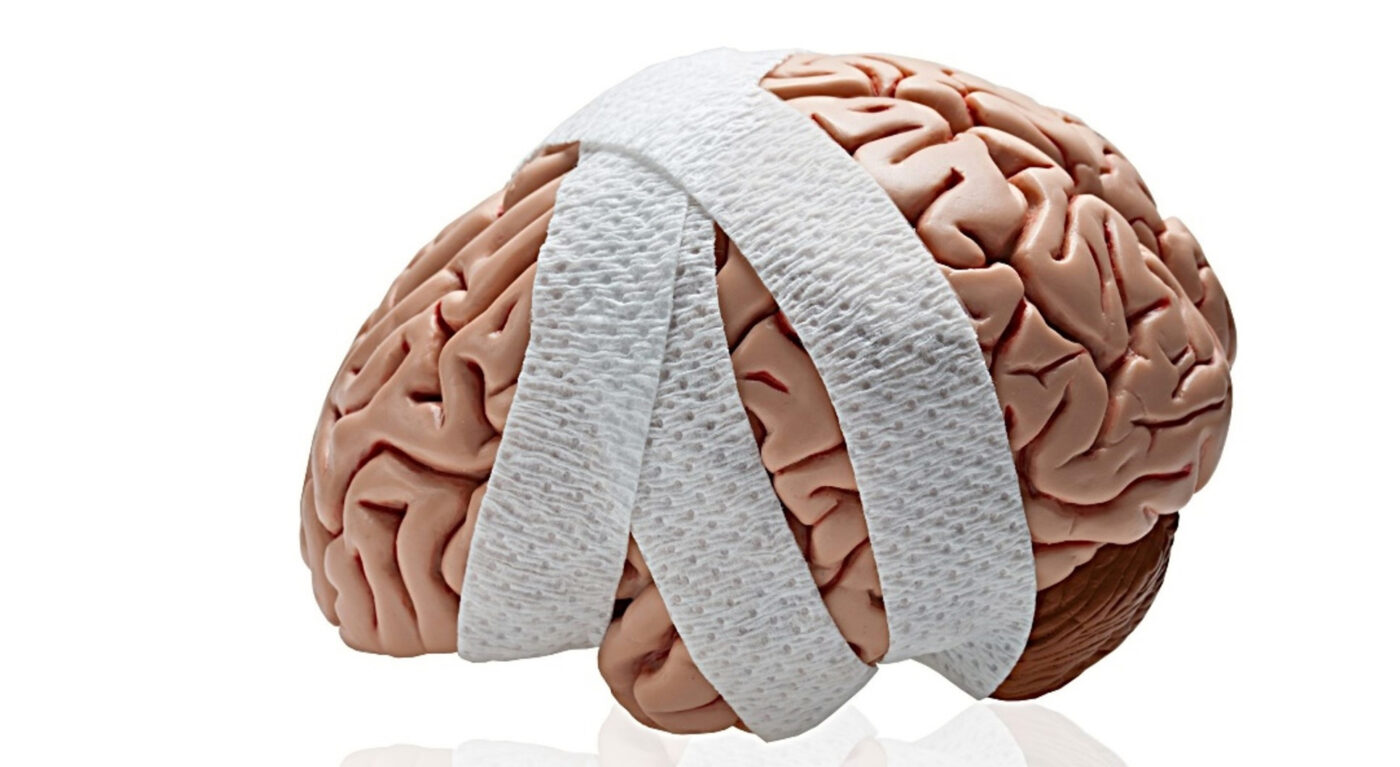 Post Concussion Syndrome | Guide to Symptoms, Diagnosis & Treatment