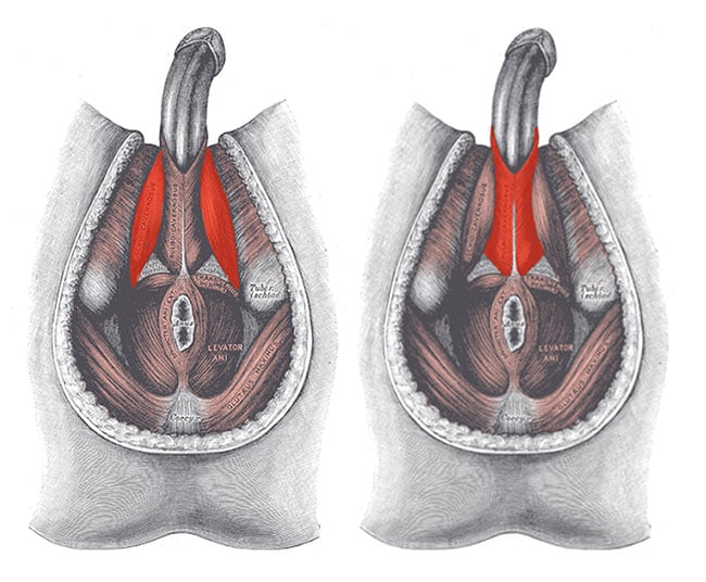 Pelvic Physiotherapy Treatment for Erectile Dysfunction